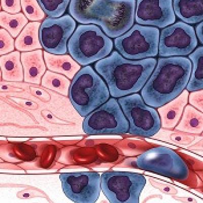 Project provides ‘unprecedented understanding’ of cancers | MDedge ...