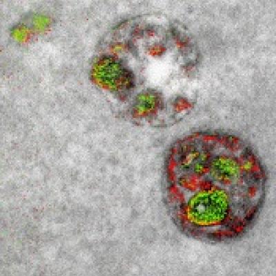 Team develops multicolor electron microscopy | MDedge Hematology and ...