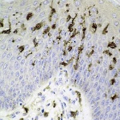 Dendritic cells promote Myc-driven lymphoma | MDedge Hematology and ...