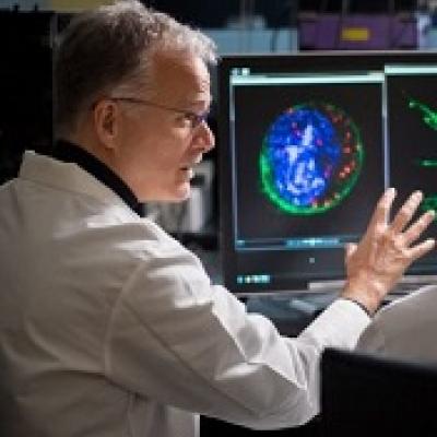Team discovers mechanism of resistance in AML | MDedge Hematology and ...