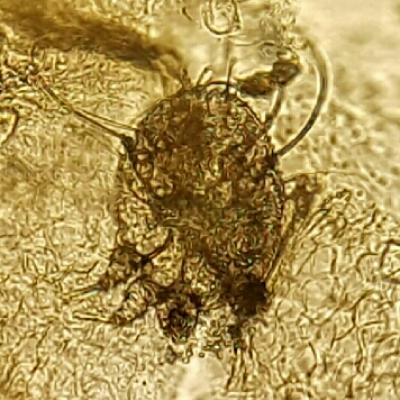 The Itch That Won't Quit | Clinician Reviews