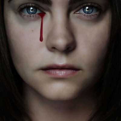 Seeing is bleeding, and smelling is perceiving | MDedge Emergency Medicine